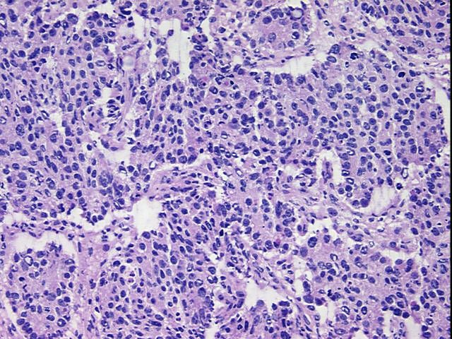 CB502757 – Frozen Tissue Blocks, Cervix | OriGene