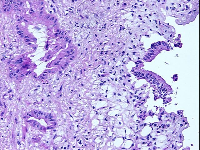 CB505253 – Frozen Tissue Blocks, Bile duct | OriGene