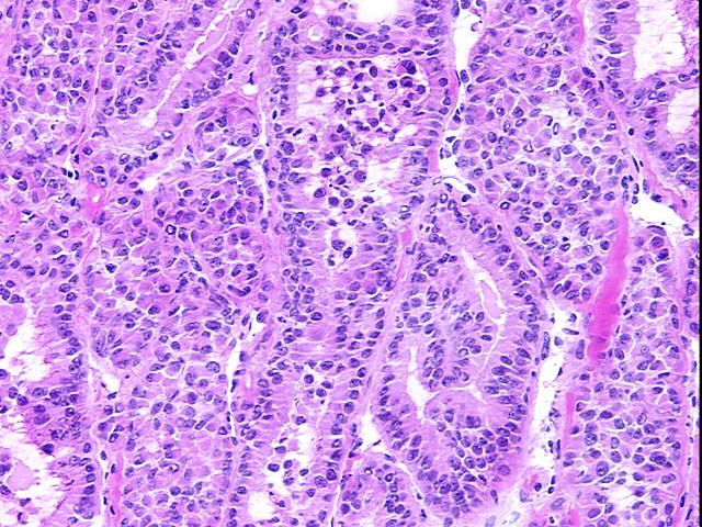 Frozen Tissue Blocks, Thyroid gland – CB610249 | OriGene