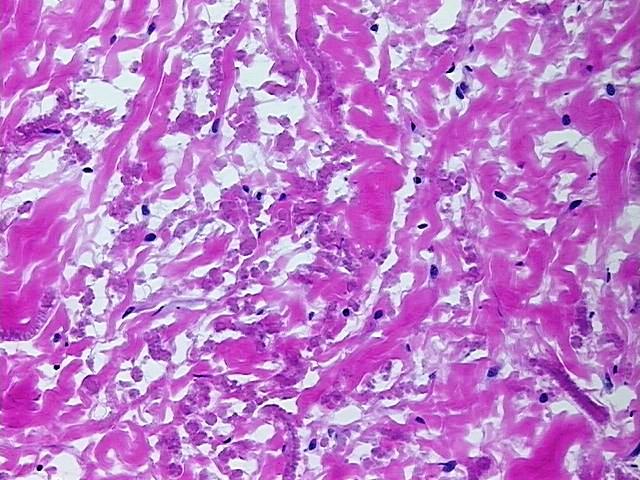 Frozen Tissue Blocks, Soft tissue – CB628072 | OriGene