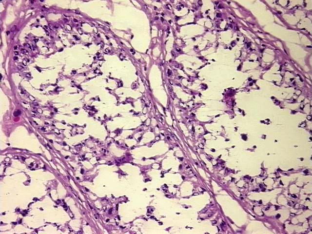 Frozen Tissue Blocks, Testis – CB814484 | OriGene