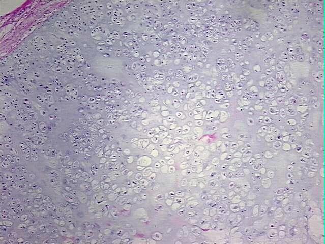 Cs602674 Frozen Tissue Sections Cartilage Origene