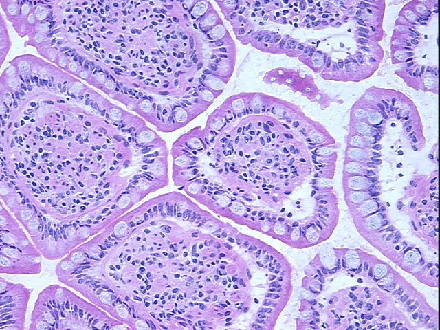 CS615535 | Frozen Tissue Sections, Small intestine Clinisciences