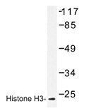 Histone H3 Rabbit Polyclonal Antibody | OriGene Technologies Inc.
