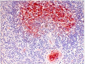 Complement SC5b-9 (TCC / MAC) Mouse Monoclonal Antibody [Clone ID: X-11 ...