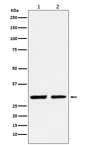 DLX5 Rabbit Monoclonal Antibody [Clone ID: OTIRA1617] | OriGene ...