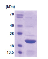 Ferritin light chain (FTL) (1-175) Human Protein | AR09026PU-L ...