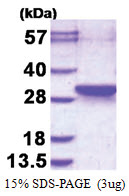LDOC1L (1-239, His-tag) Human Protein | OriGene Technologies Inc.