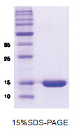 Alpha-Synuclein / SNCA Human Protein | SA6004 | OriGene Technologies Inc.