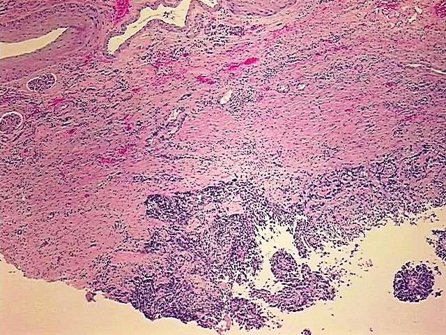 FFPE Tissue Blocks, Multiple urinary system sites | OriGene ...