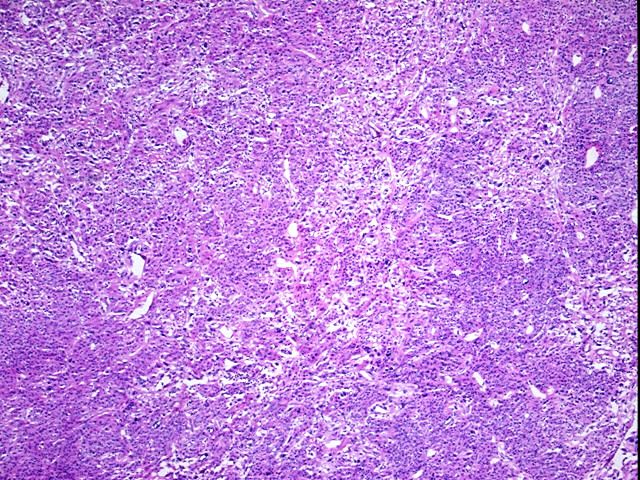 Frozen Tissue Blocks, Smooth muscle | OriGene Technologies Inc.