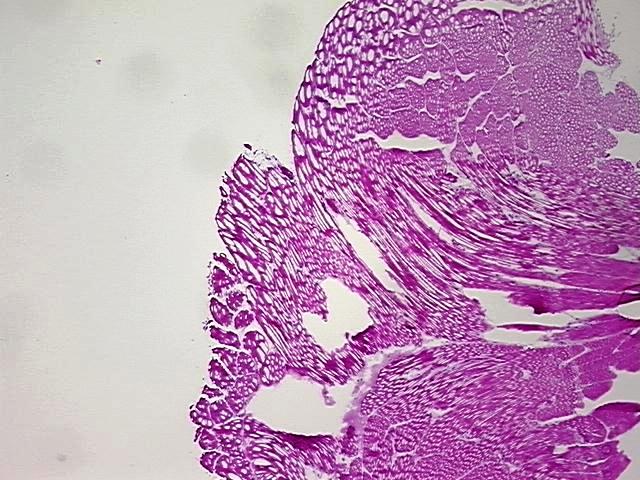 Frozen Tissue Blocks, Muscle tissue | OriGene Technologies Inc.