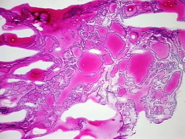 Frozen Tissue Blocks, Mediastinum | CB506382 | OriGene Technologies Inc.