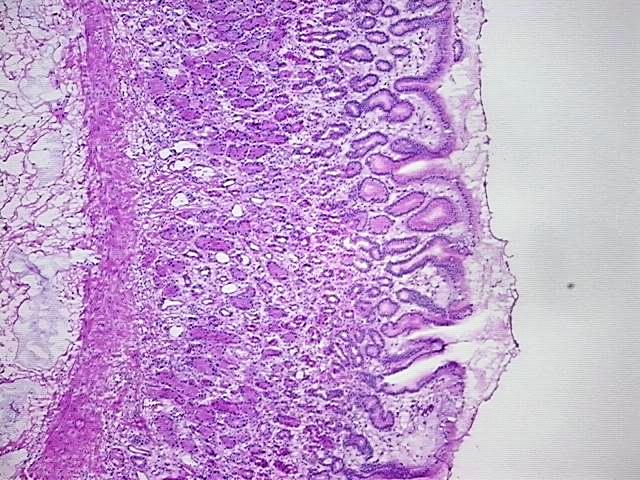 Frozen Tissue Blocks, Stomach | OriGene Technologies Inc.