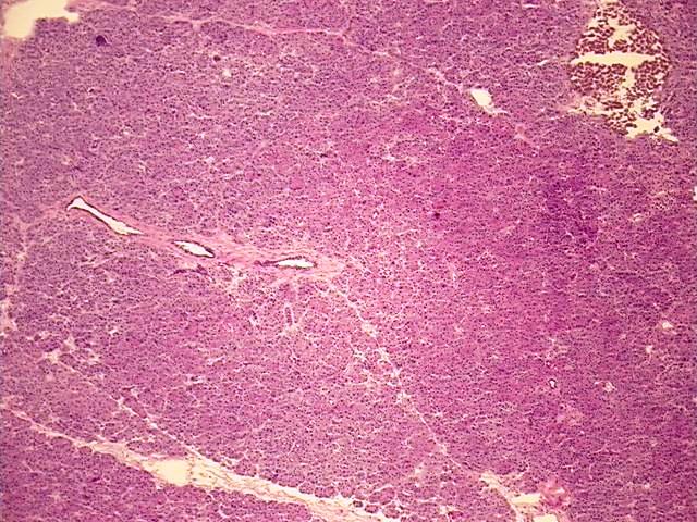 Frozen Tissue Blocks, Pancreas | OriGene Technologies Inc.