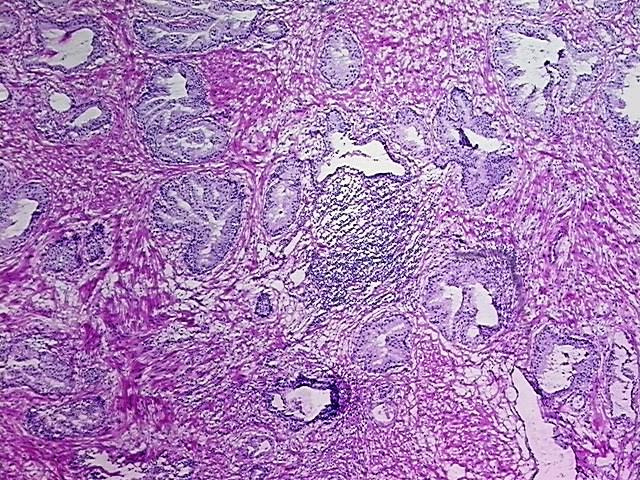 Frozen Tissue Blocks, Prostate | CB539234 | OriGene Technologies Inc.