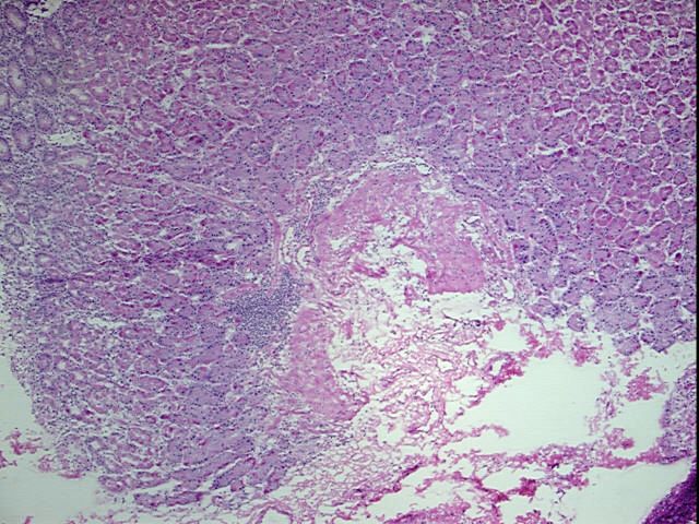 Frozen Tissue Blocks, Stomach | CB609852 | OriGene Technologies Inc.