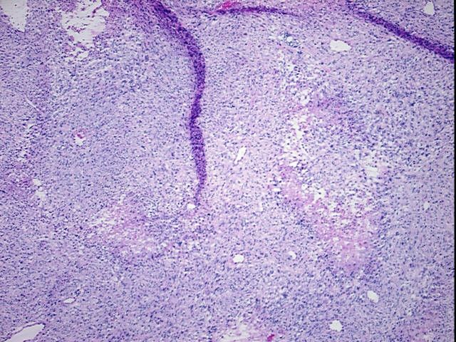 Frozen Tissue Blocks, Uterus | CB618361 | OriGene Technologies Inc.