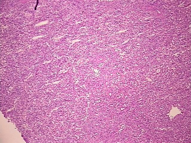 Frozen Tissue Blocks, Myeloid tissue | OriGene Technologies Inc.