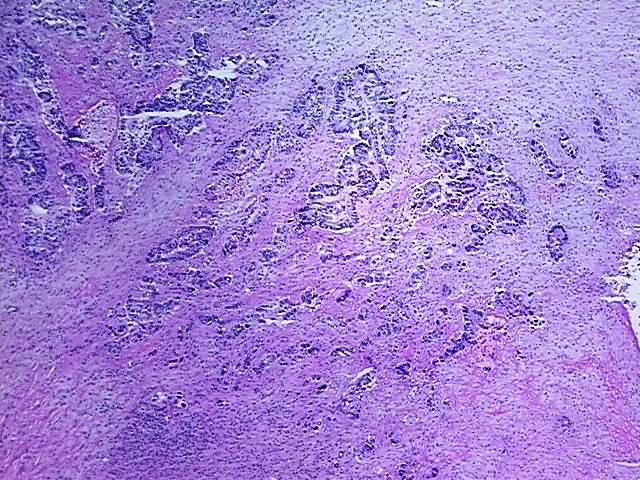 Frozen Tissue Sections, Gallbladder | OriGene Technologies Inc.