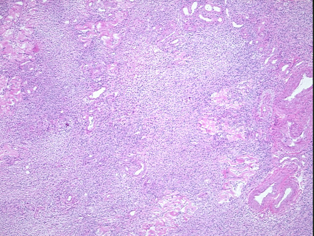 Frozen Tissue Sections, Ovary | OriGene Technologies Inc.