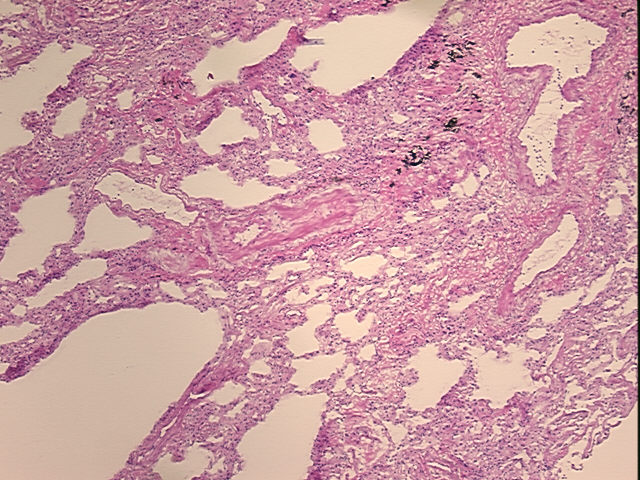 Frozen Tissue Sections, Lung | OriGene Technologies Inc.