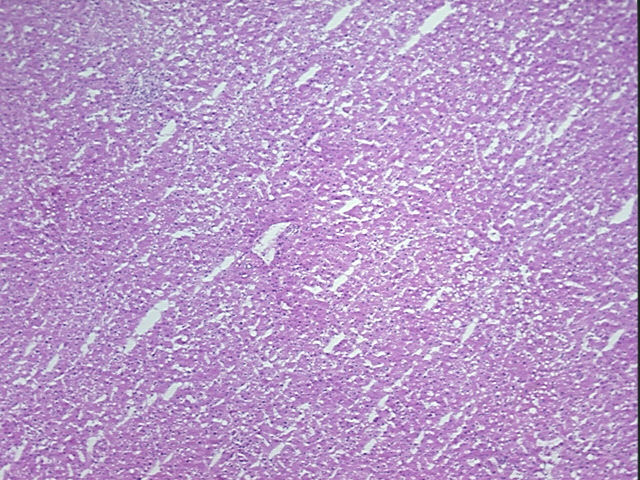 Frozen Tissue Sections, Liver | OriGene Technologies Inc.