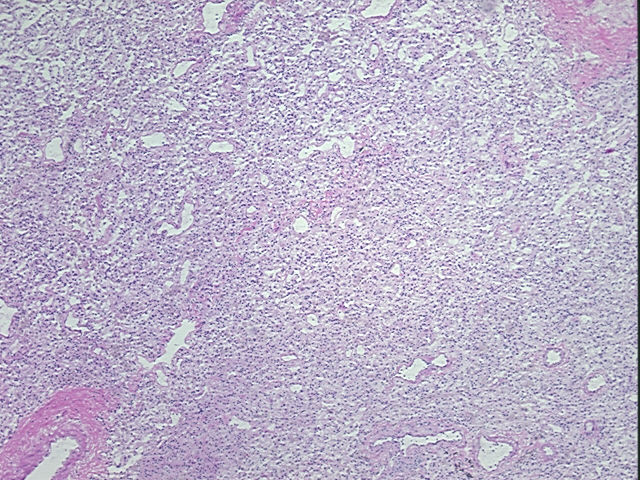 Frozen Tissue Sections, Lung | OriGene Technologies Inc.