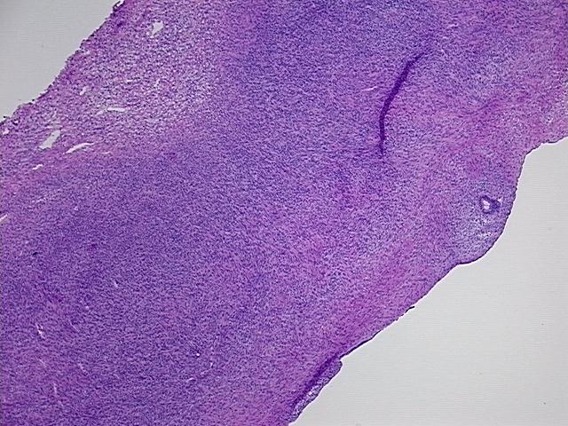 Frozen Tissue Sections, Ovary: right | CS508862 | OriGene Technologies Inc.