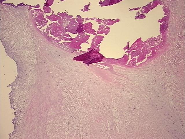 Frozen Tissue Sections, Aortic valve | CS511352 | OriGene Technologies Inc.