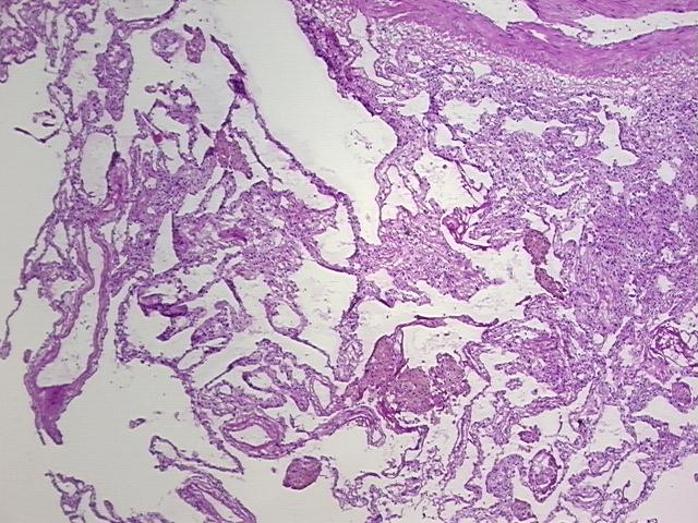 Frozen Tissue Sections, Lung | OriGene Technologies Inc.