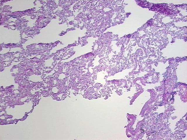 Frozen Tissue Sections, Lung | OriGene Technologies Inc.