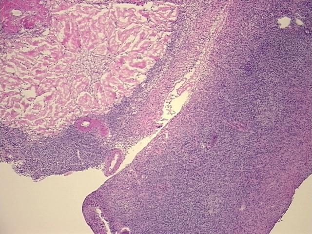 Frozen Tissue Sections, Ovary: right | OriGene Technologies Inc.