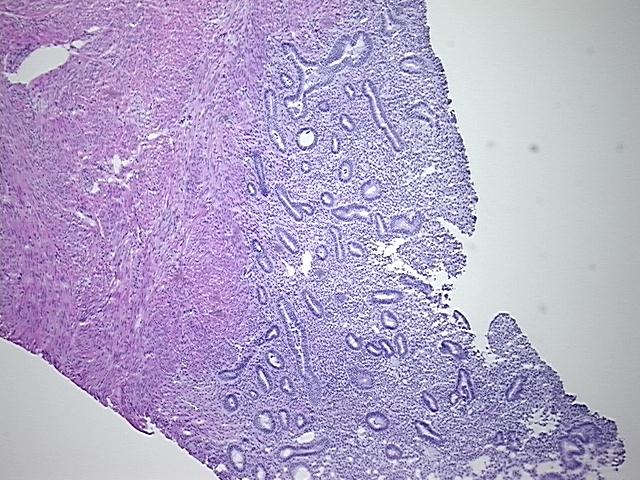 Frozen Tissue Sections, Uterus | OriGene Technologies Inc.