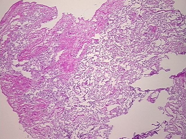 Frozen Tissue Sections, Lung | OriGene Technologies Inc.
