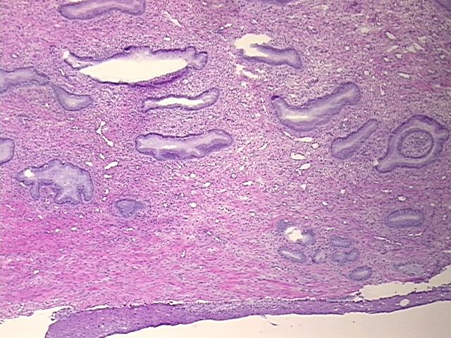 Frozen Tissue Sections, Cervix | OriGene Technologies Inc.