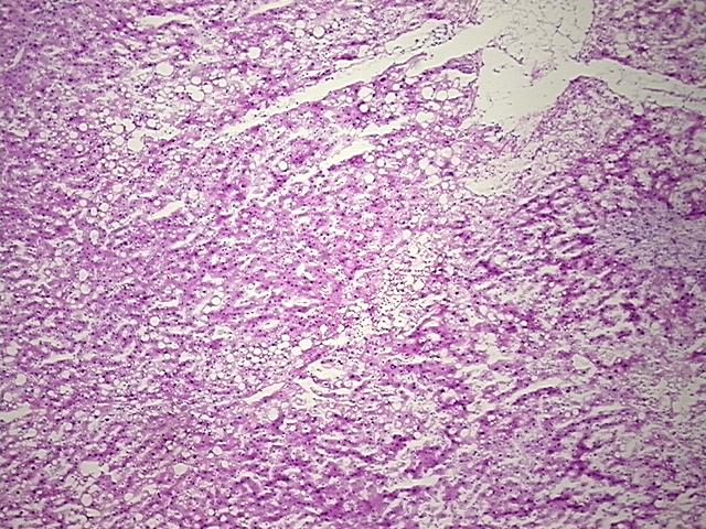 Frozen Tissue Sections, Liver | CS526004 | OriGene Technologies Inc.