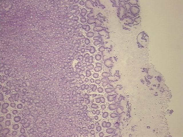 Frozen Tissue Sections, Stomach | CS527762 | OriGene Technologies Inc.
