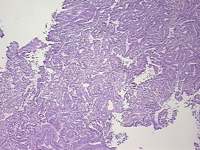 Frozen Tissue Sections, Endometrium | OriGene Technologies Inc.