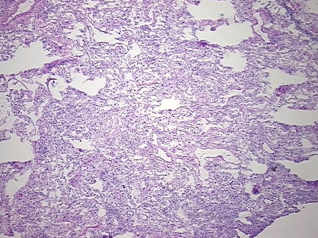 Frozen Tissue Sections, Lung | CS529150 | OriGene Technologies Inc.