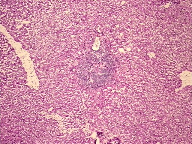 Frozen Tissue Sections, Liver | OriGene Technologies Inc.