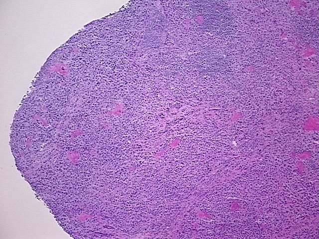 Frozen Tissue Sections, Urinary bladder | CS531917 | OriGene ...