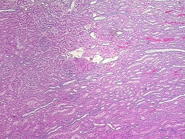 Tissue FFPE Sections, Kidney | OriGene Technologies Inc.