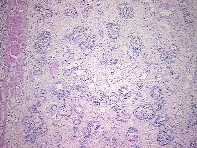 Frozen Tissue Sections, Stomach | CS532555 | OriGene Technologies Inc.