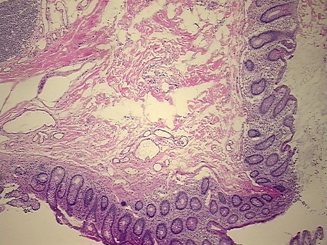 Frozen Tissue Sections, Colon | CS534807 | OriGene Technologies Inc.