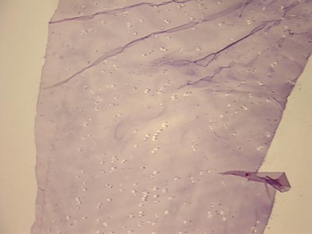 Frozen Tissue Sections, Cartilage: femur, distal | CS538605 | OriGene ...