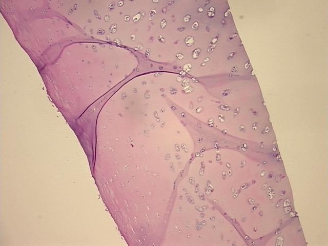 Frozen Tissue Sections, Cartilage: tibia, proximal | CS539999 | OriGene ...