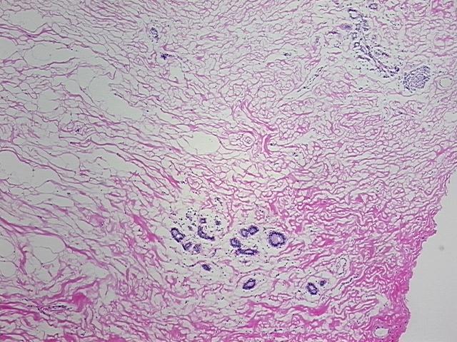 Frozen Tissue Sections, Breast | OriGene Technologies Inc.