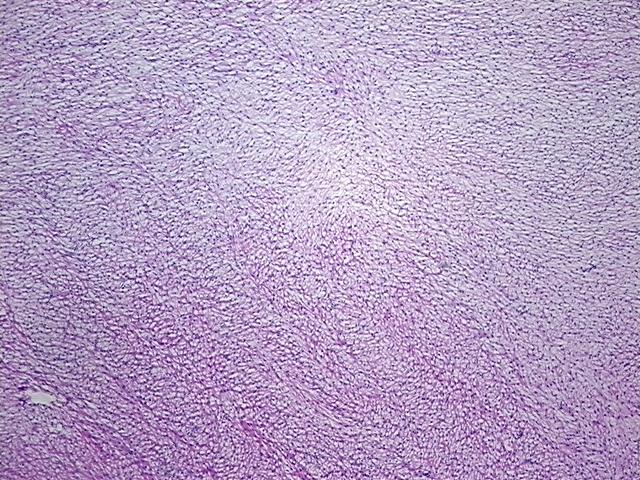 Frozen Tissue Sections, Ovary: right | OriGene Technologies Inc.