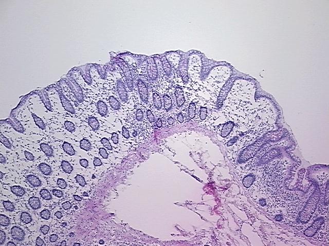 Frozen Tissue Sections, Colon: right | OriGene Technologies Inc.